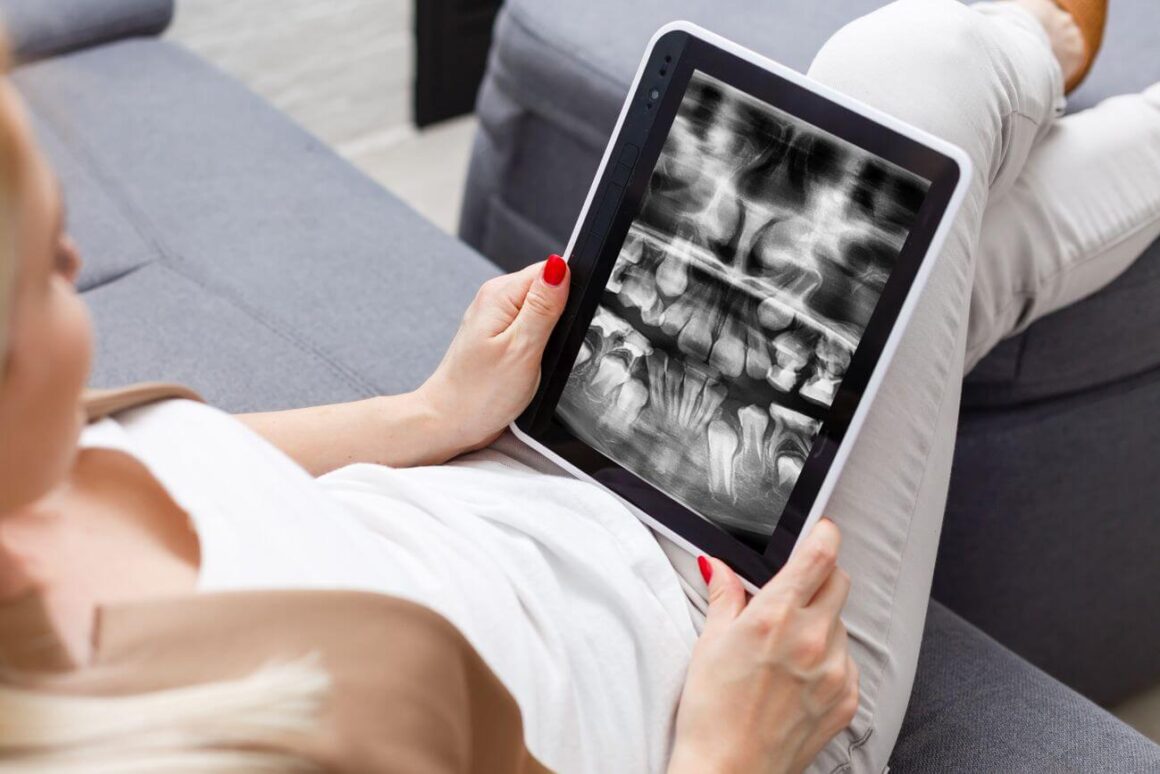 Pantomogram – zdjęcie panoramiczne zębów - Okiem dentystki